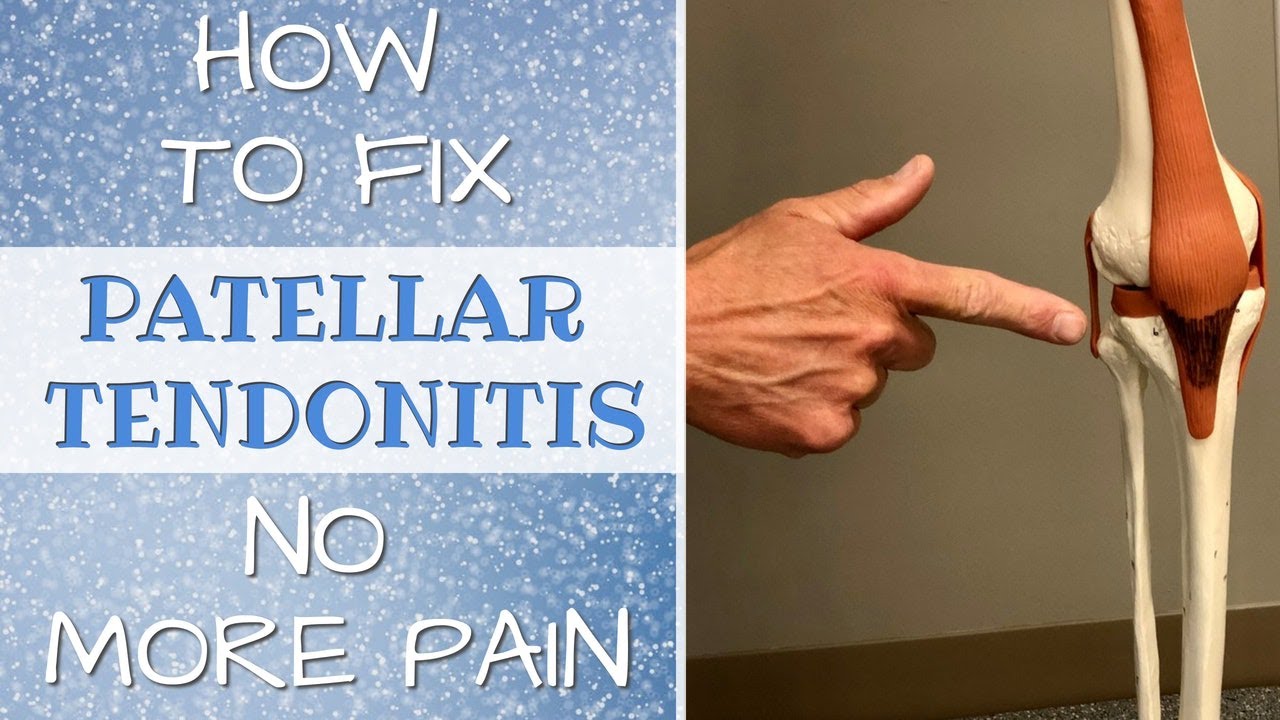How To Fix Patellar Tendonitis, No More Pain & Self Treatment - MED PODD